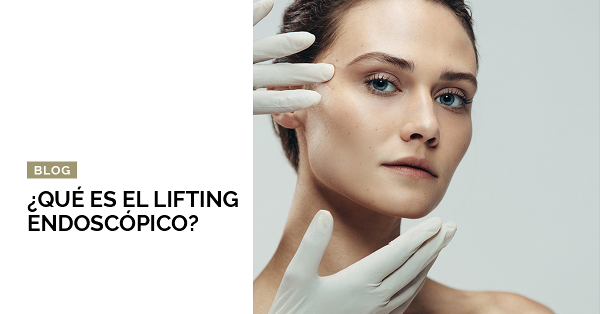 ¿Qué es el lifting endoscópico?
