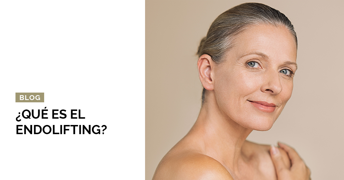 ¿Qué es el endolifting?